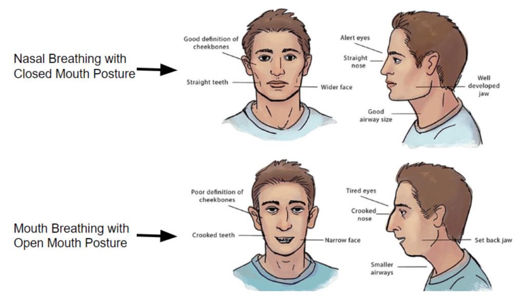 GOPex: Good Oral Posture Exercises - Apex Dental